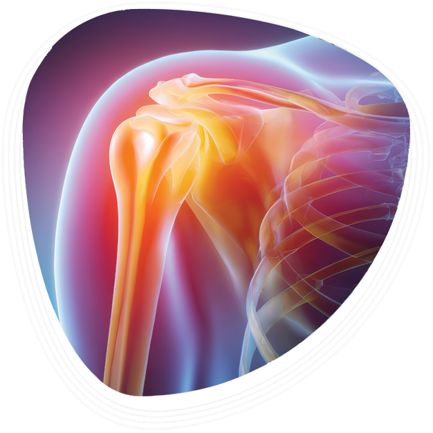 Frozen Shoulder (Adhesive Capsulitis) Treatment in Dehradun ...