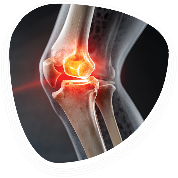 Knee Pain Treatment in Dehradun | Graphic Era Hospital