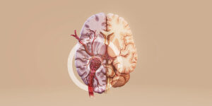 Blood Clot in Brain: Symptoms, Types, Causes & Treatment | Graphic Era ...